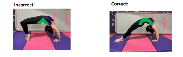Back pain in gymnastics - Gymnastics Medicine