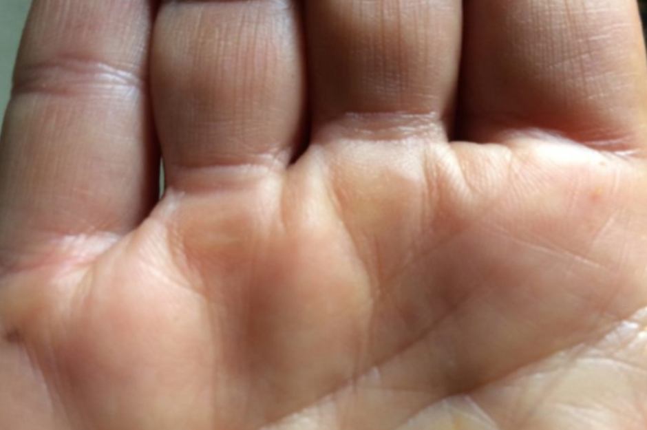 Rip Care 101: While In (and Out) of Season - Gymnastics Medicine